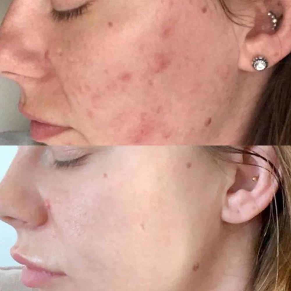 Aspect Dr Chemical Peels